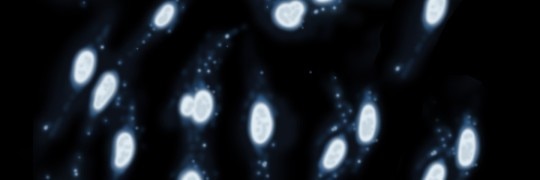 Cell Culture FAQ: What is the best test method for mycoplasma ...