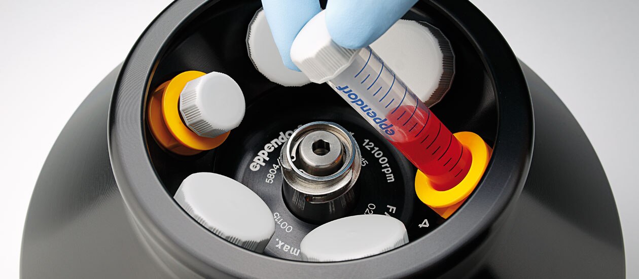 Centrifugation Needs of Vessel Types According to the Application ...