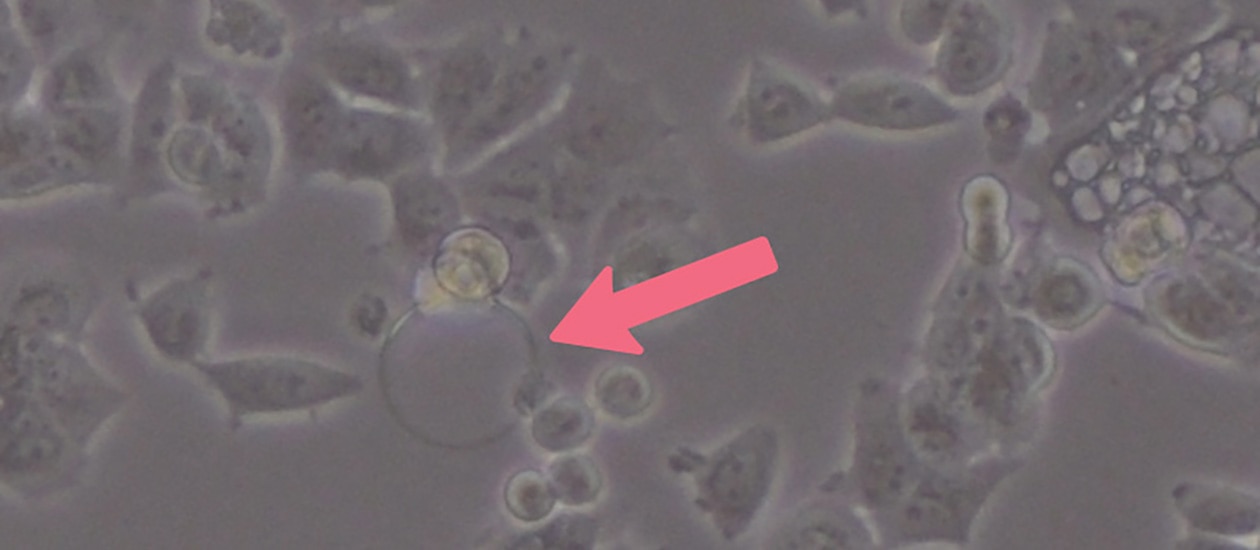 Cell seeding protocol – Guide on how to seed cells correctly ...