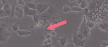 Cell seeding protocol – Guide on how to seed cells correctly ...