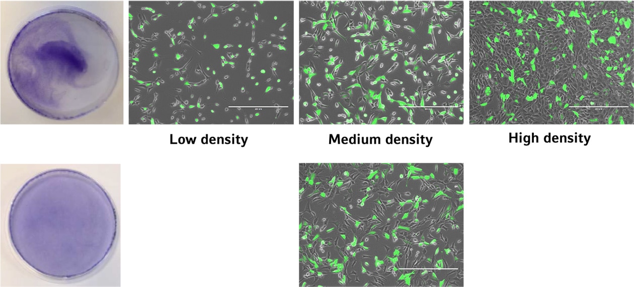 Cell seeding protocol – Guide on how to seed cells correctly ...