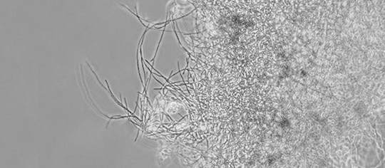 How to identify fungal contamination in your cell culture - Eppendorf Japan