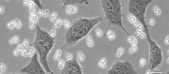 How to detect a yeast contamination in your cell culture - Eppendorf Spain