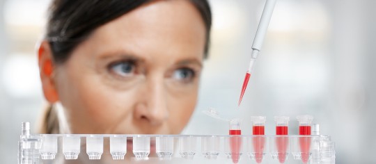 Impact of Pipetting Techniques on Precision and Accuracy - Eppendorf US