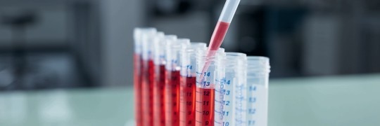 Liquid Handling FAQ - Eppendorf US