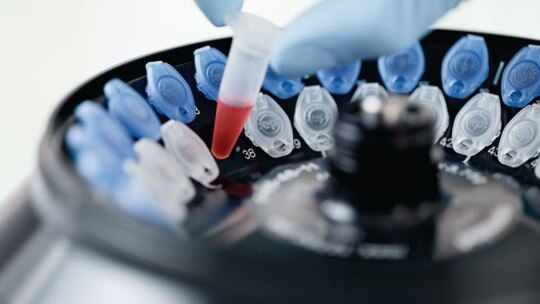 Your Sample. Our Passion. Sampling Handling is Key. - Eppendorf Deutschland